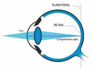Biometria Ultrassônica e Biometria Óptica (Iol Master) - Oftalmologia RPL